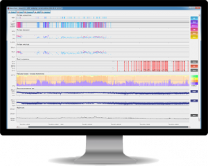 EEG trending US - encevis