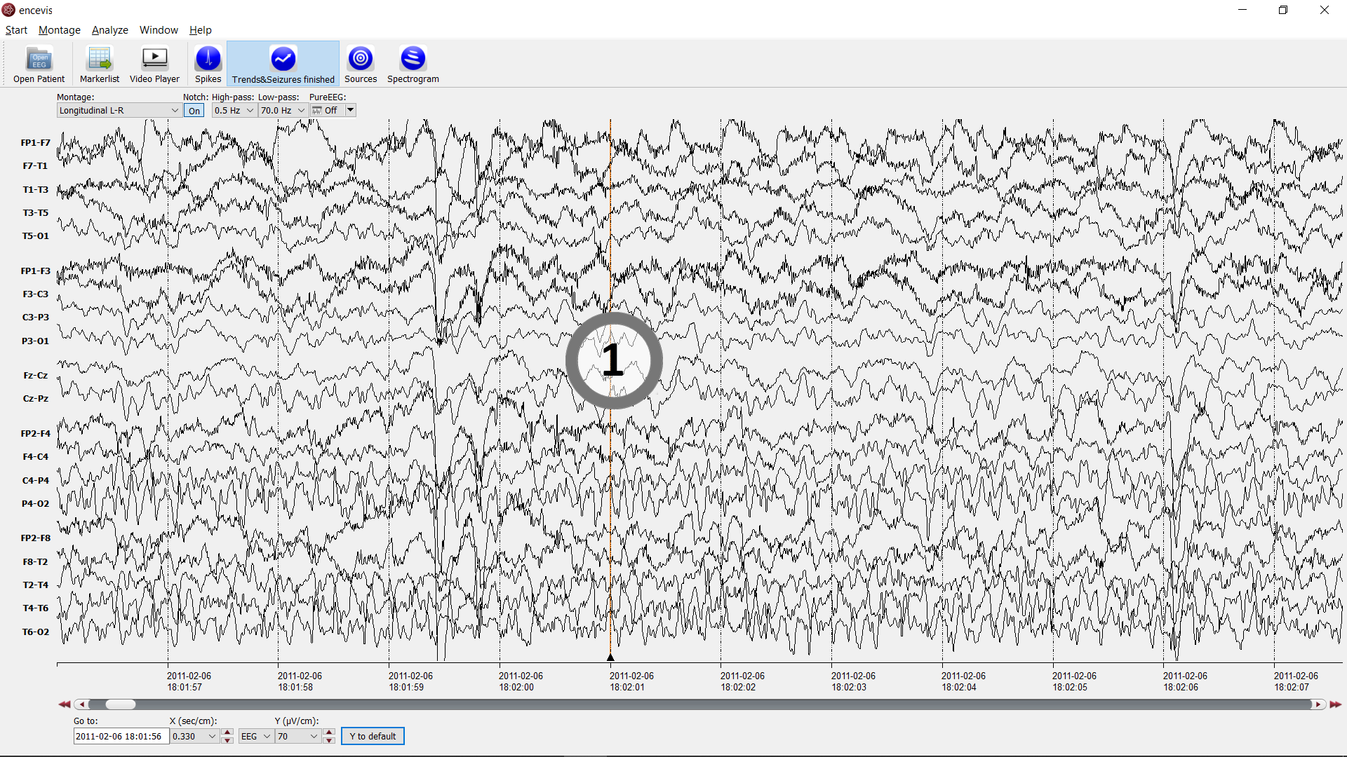 Case study encevis NeuroTrend 3h - encevis