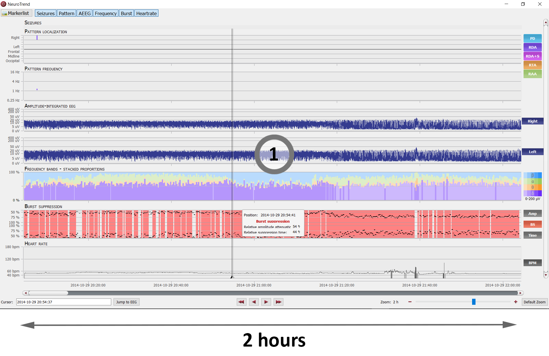 Case study encevis NeuroTrend 24h - encevis